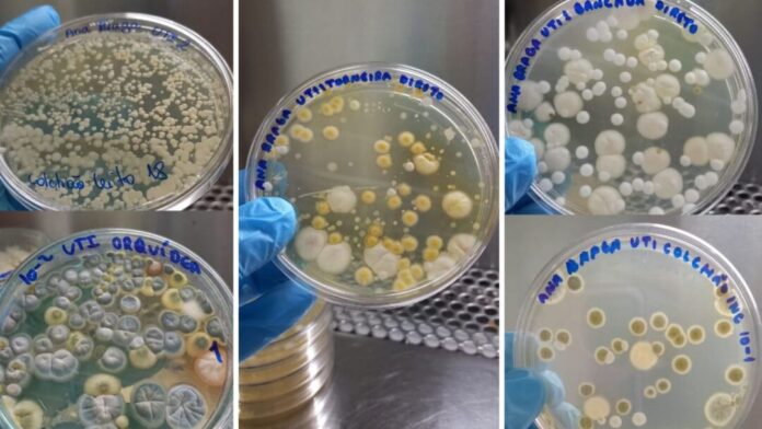 Pesquisa avalia espécies de cândida na rede de esgoto hospitalar em ...